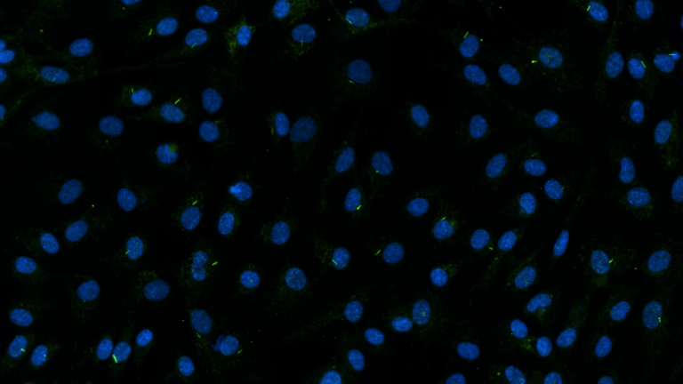 Nervous System - BiCell Blue