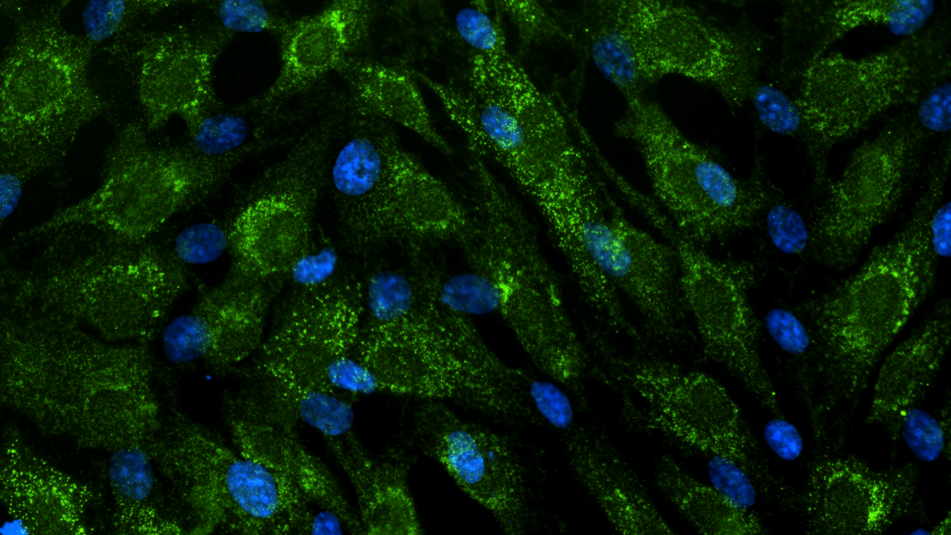Nervous System - BiCell Blue