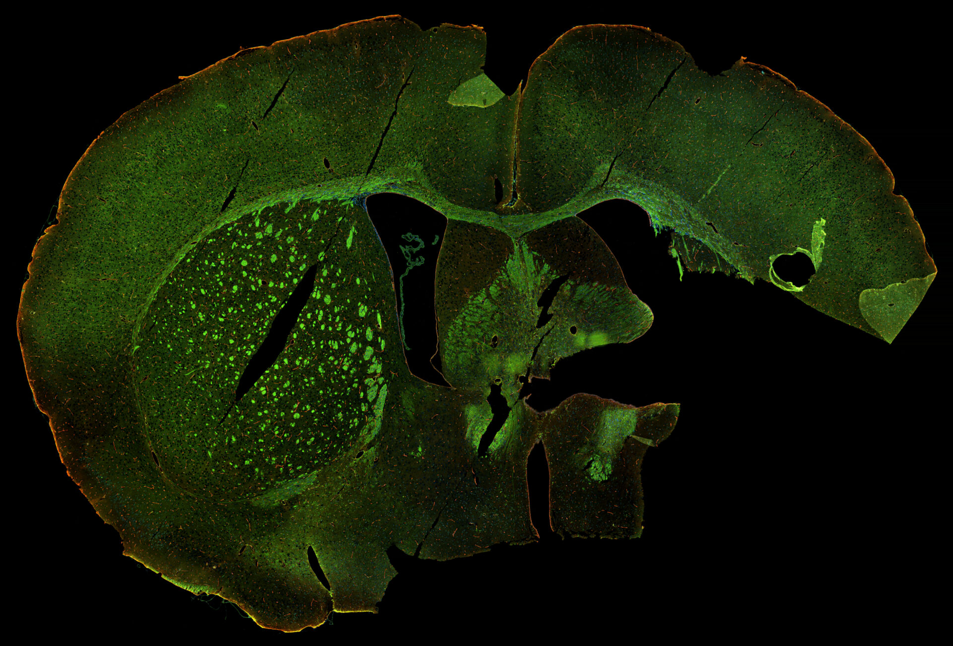 Mouse brain section labeled with SHANK1 and Aqp4 antibody - BiCell Blue