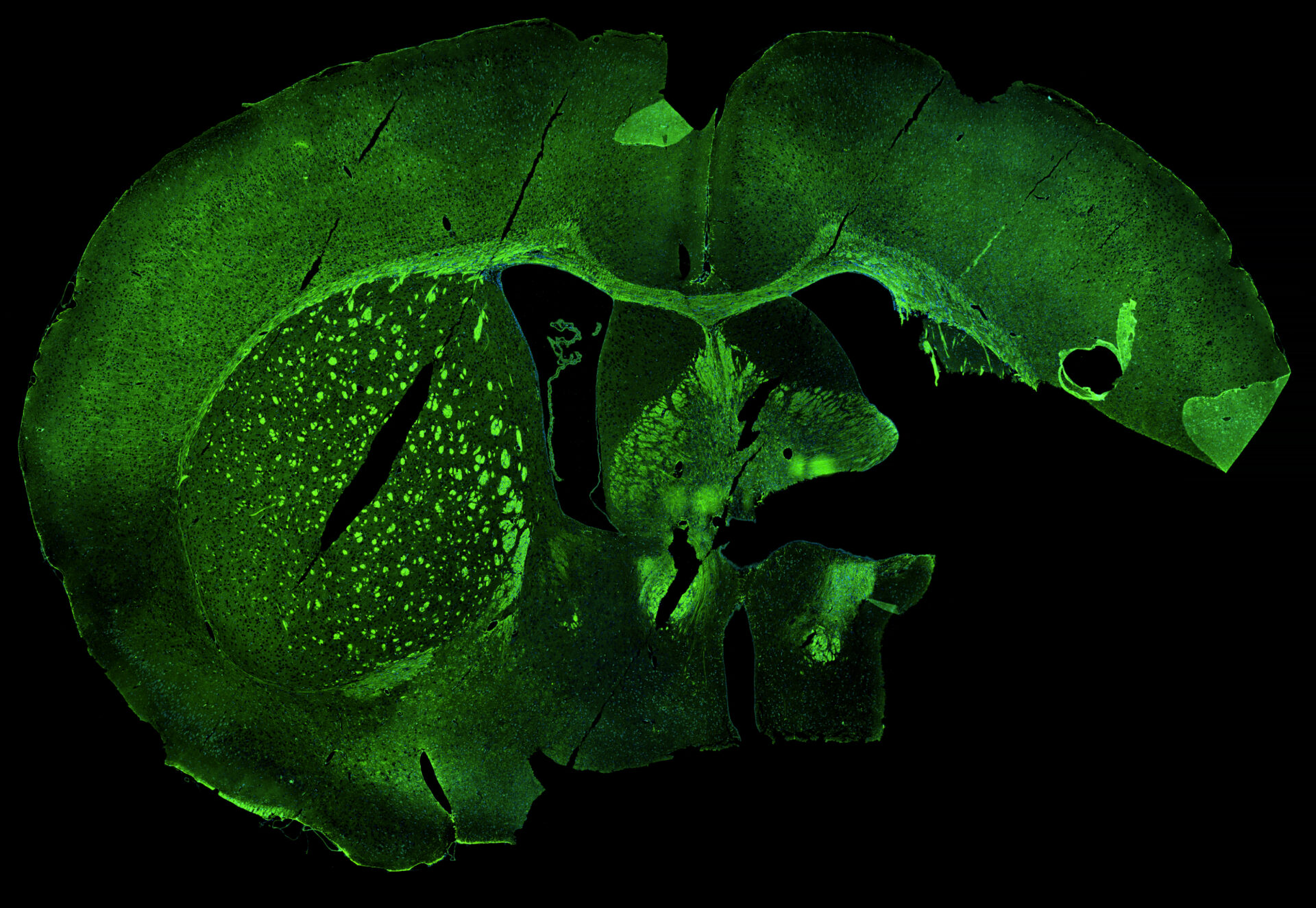 Mouse brain section labeled with SHANK1 antibody (SHANK1/Aqp4 dataset ...